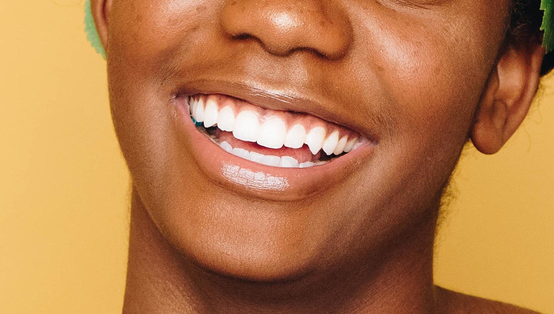 Unveiling Your Brightest Smile: Natural Teeth Whitening Options - Marx ...